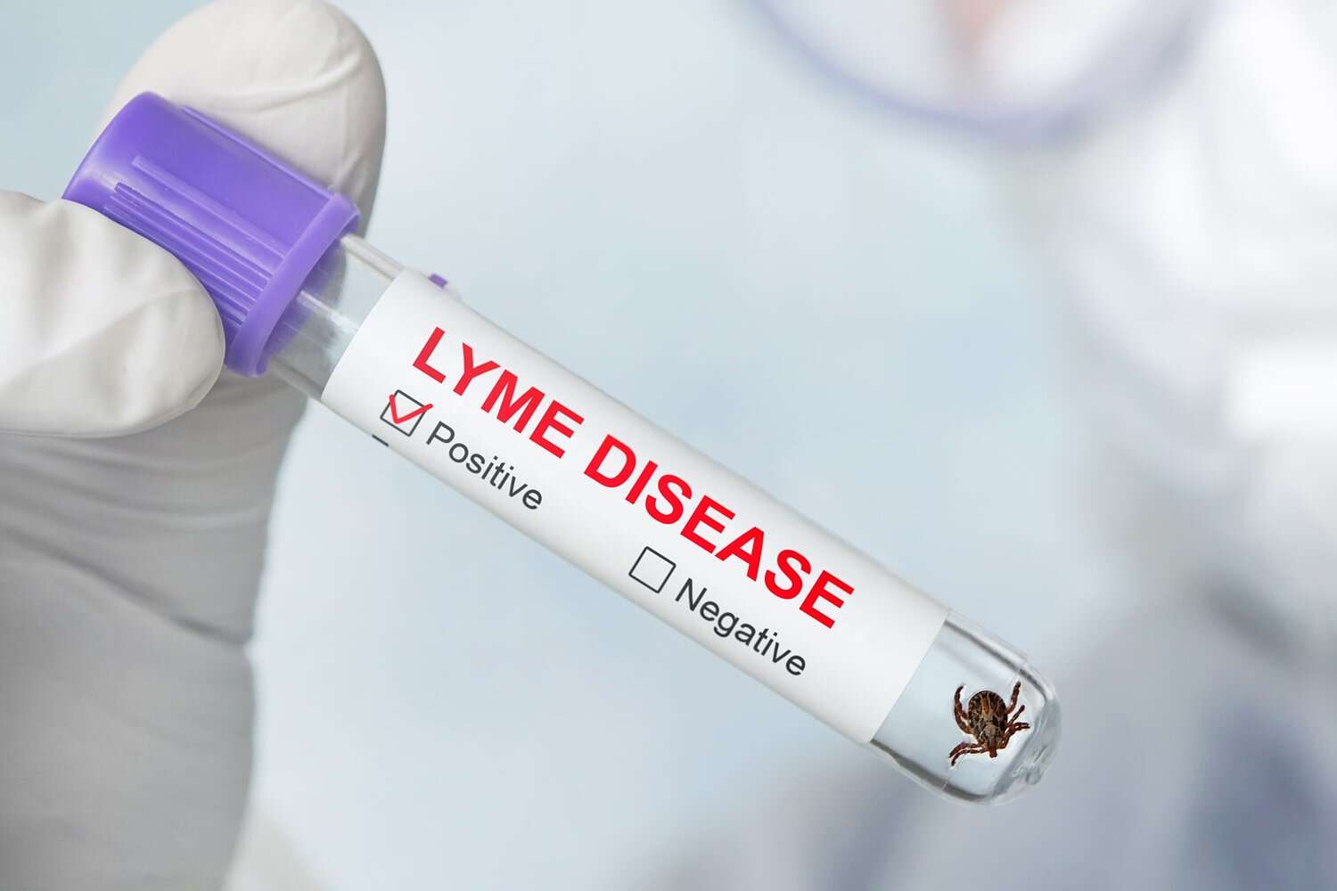 Lyme disease vaccine by Valneva up for final stage clinical trials ...